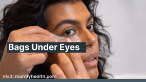 Bags Under Eyes - Causes And Everything You Need To Know